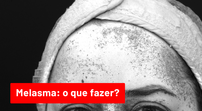 Patologias da Estética Archives - João Tassinary