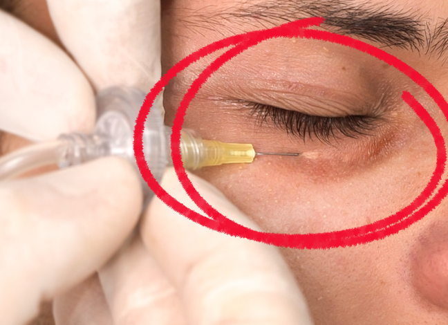 Carboxiterapia Archives João Tassinary