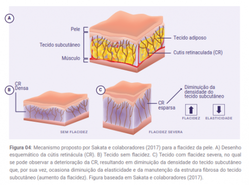 Tudo o que você precisa saber sobre o tratamento de flacidez - João ...